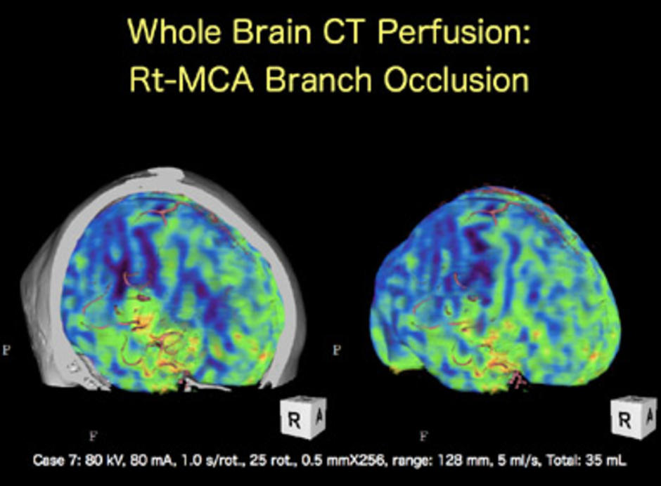 เครื่องเอกซเรย์คอมพิวเตอร์ 256 สไลด์ - GotoKnow