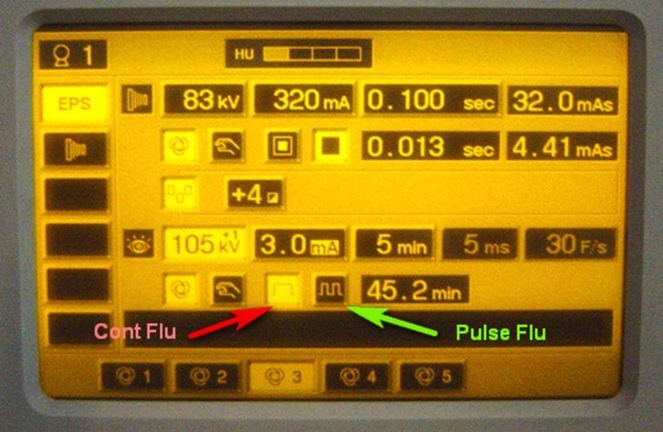 ประโยชน์ของการฉายรังสีเป็นช่วง (Pulse Fluoroscopy) - รังสีเทคนิคขอนแก่น
