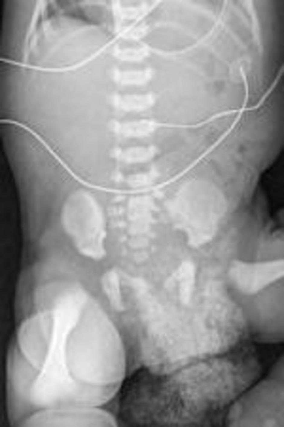 Wet diapers create imaging artifacts - GotoKnow