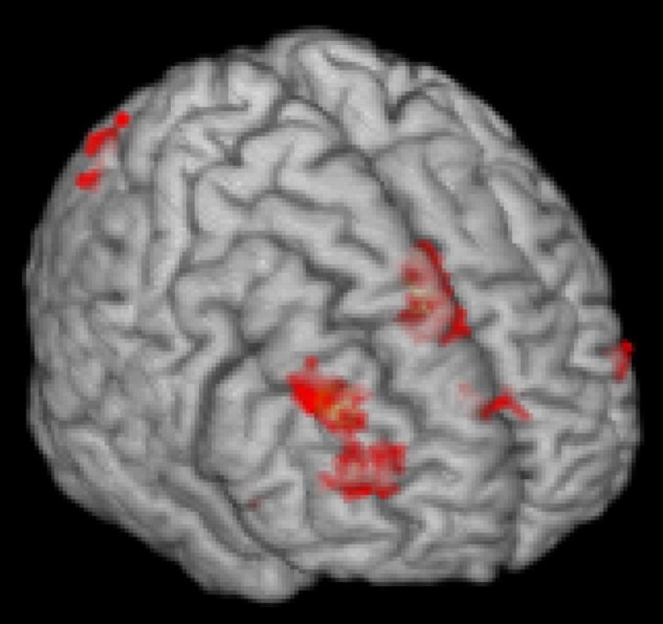 fMRI proves honest people don’t even think about lying - KM of RT for RT